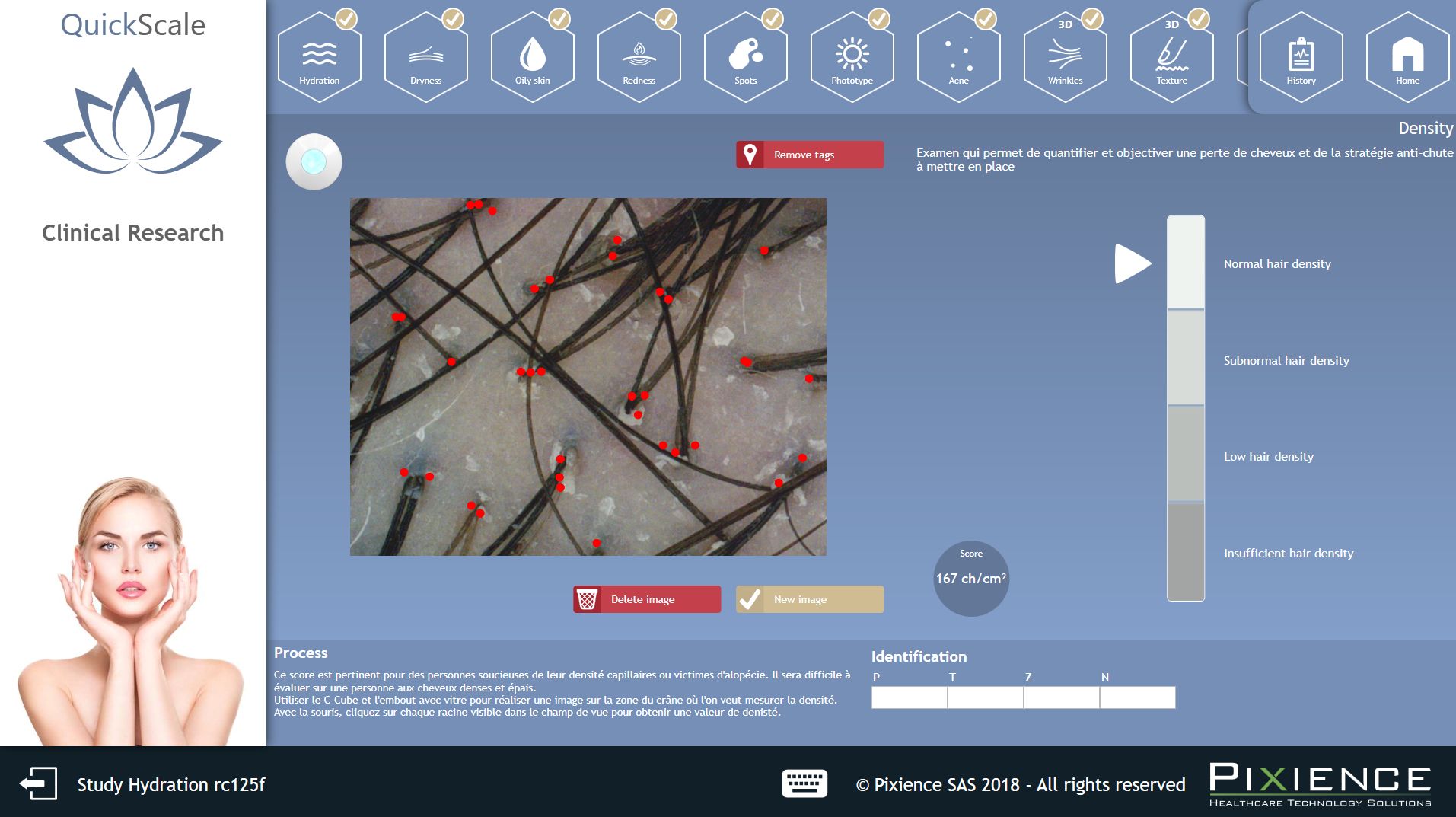 Logiciel QuickScale - Pixience