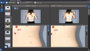 BodyMapper - Pixience