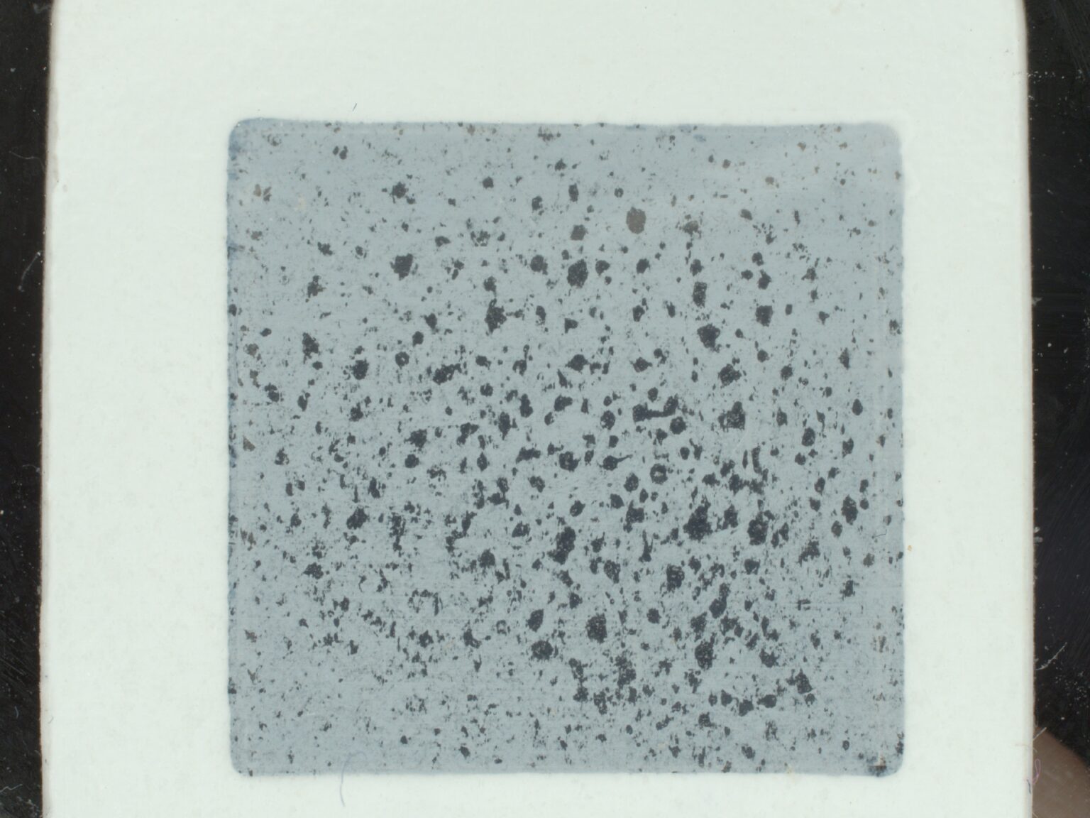 Acne evaluation with C-Cube 3 - Pixience