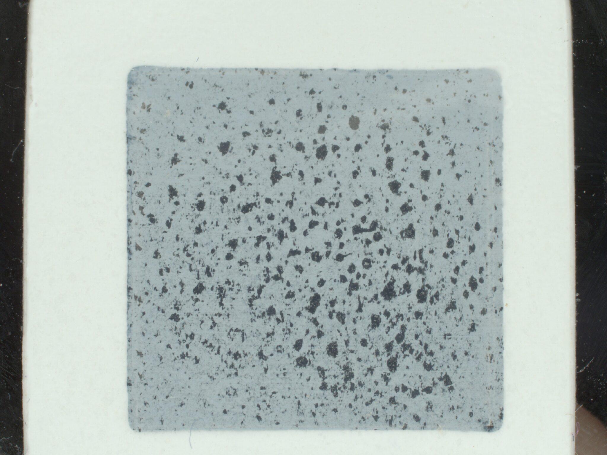 Acne evaluation with C-Cube 3 - Pixience